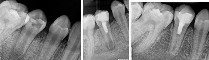 Regenerative Procedures Rochester MN